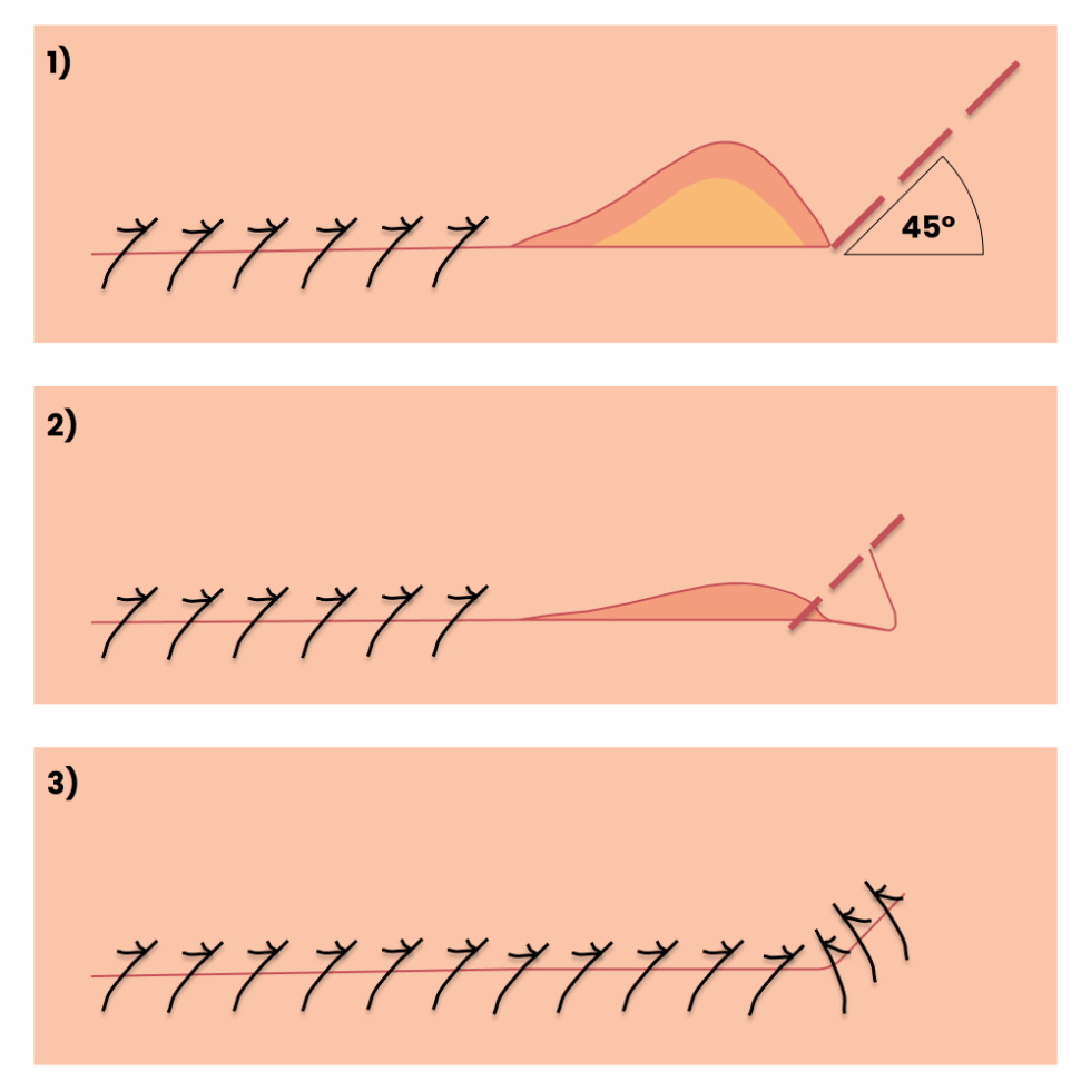 Dog Ear | Suture.app