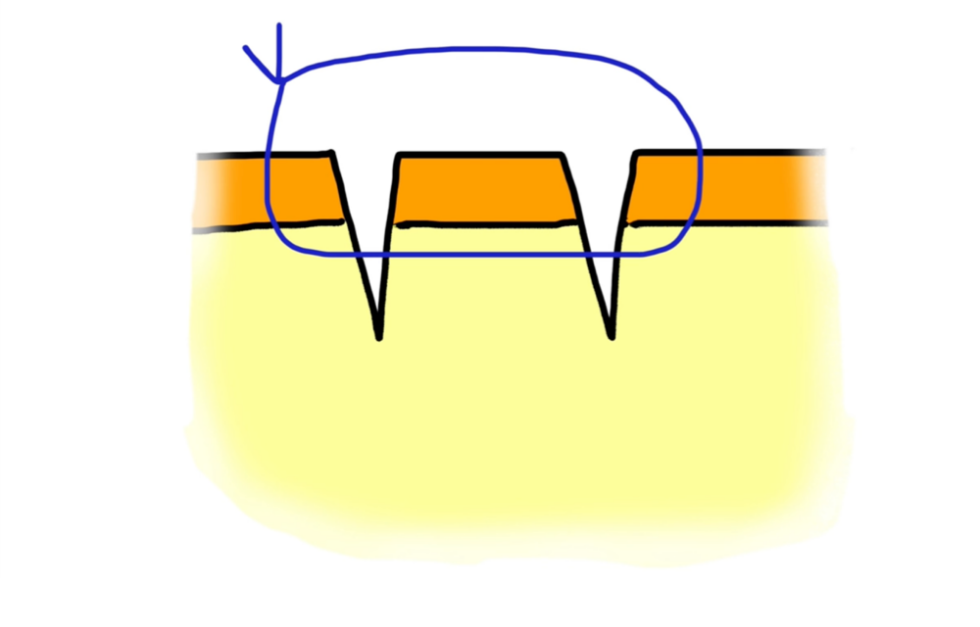 Parallel | Suture.app