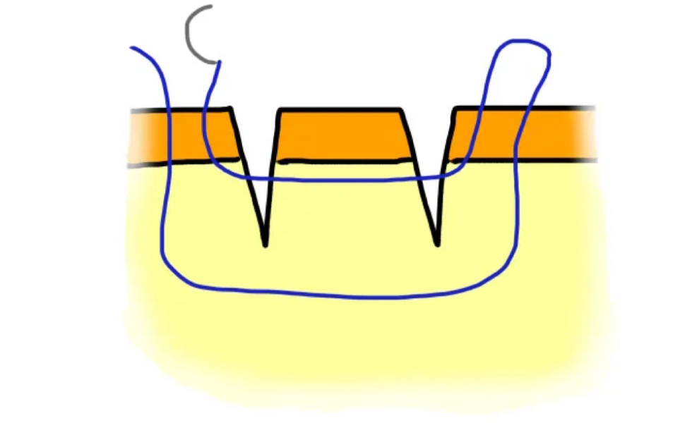 Parallel | Suture.app